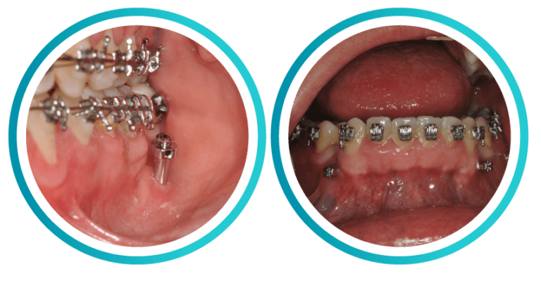 Webinar – Ortodoncia